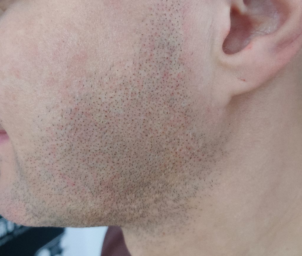 Îndesire Barbă - Hairodot